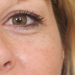 Before & After using The Face Wrap – TheFaceWrap.com